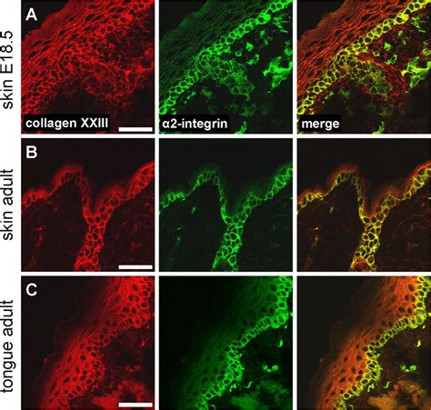 Collagen Xxiii Novel Ligand For Integrin α2β1 In The Epidermis