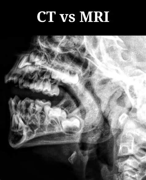 Ct Vs Mri A Deep Dive Into Medical Imaging Technology