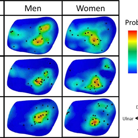 Finite Element Model Showing An Unconstrained First Metacarpal Fixed