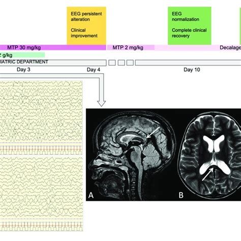 Neurological Management Algorithm Eeg Electroencephalography Mri