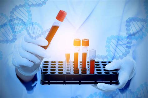 Liposome In Vitro Bioactivity Evaluation Cd Formulation