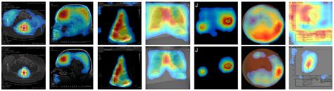 Visual Interpretation Of Convolutional Neural Network Predictions In Classifying Medical Image