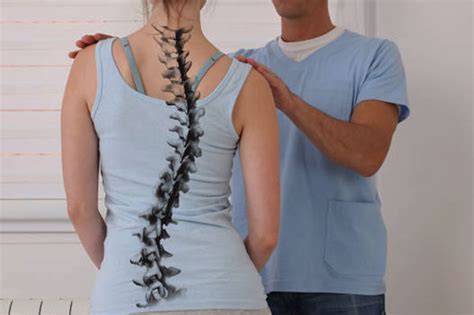 Treatment For Nerve Decompression Dr Satish
