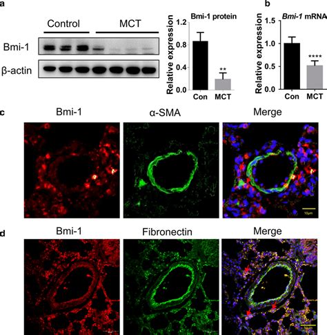 Bmi 1 Is Mainly Expressed In Pulmonary Adventitial Fibroblasts And Its