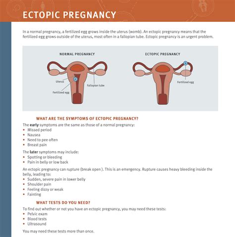 Interstitial Ectopic Pregnancy Gljy