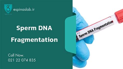 تست Sperm Dna Fragmentation آزمایشگاه اسپیناس تهران