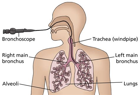 Having A Bronchoscopy Leeds Teaching Hospitals Nhs Trust