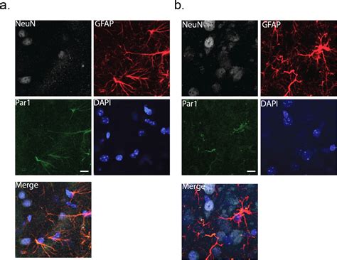 Astrocytic Modulation Of Excitatory Synaptic Signaling In A Mouse Model