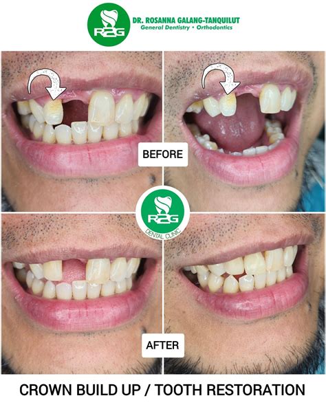 R2g Dental Clinic Set An Appointment With Us 😁 📞 0933 817 37 18 📍