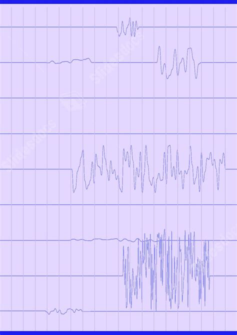 Electrocardiogram Page Border And Printable Background In Word Slidesdocs