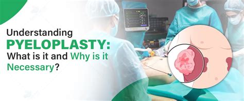 Understanding Pyeloplasty What Is It And Why Is It Necessary