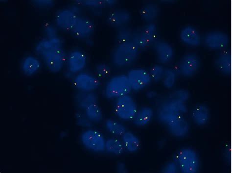 ROS1 Analyte Control HistoCyte