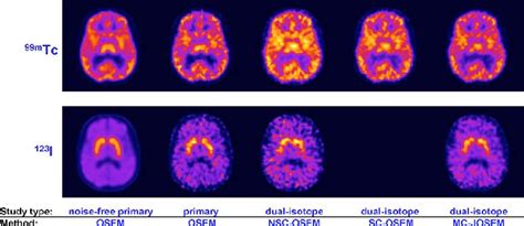 Figure 3 From Fast Monte Carlo Based Joint Iterative Reconstruction For Simultaneous 99mtc 123i