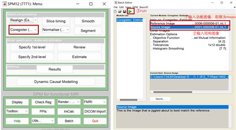 Fmri数据预处理 知乎