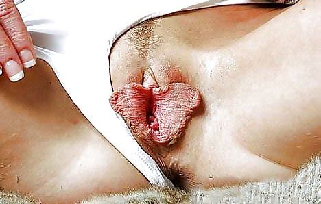 Labia Minora And Majora Porn Pictures Xxx Photos Sex Images Pictoa