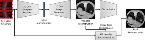 Figure 1 From Extreme Few View Ct Reconstruction Using Deep Inference