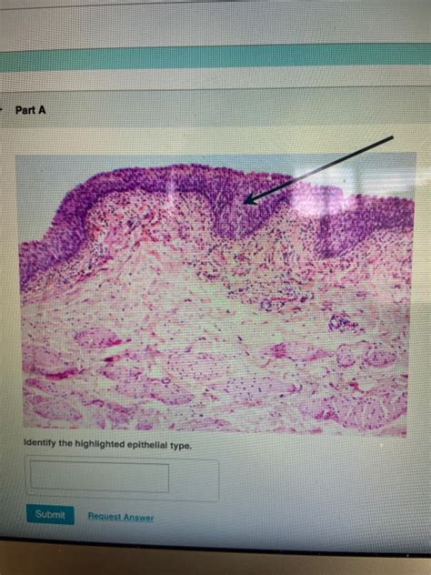 solved part a identify the highlighted epithelium submit