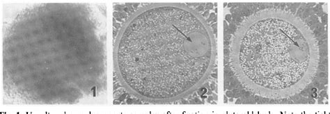 Figure 12 From Ultrastructure Of In Vitro Oocyte Maturation In Cattle Semantic Scholar