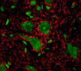 Synaptophysin