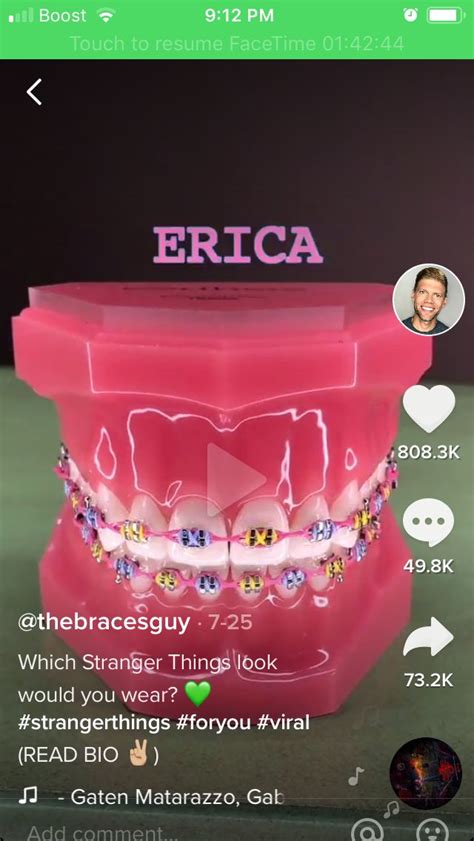 Pin By Dessi Pooh On Braces Colors Dental Braces Getting Braces