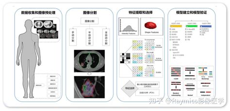 【科研】影像组学和基因组学——通往癌症治疗的精准医学之路（上篇） 知乎
