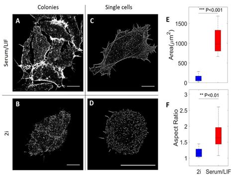 Super Resolution Based Analysis Of Actin Cytoskeleton Organization In