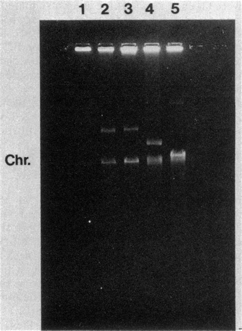 Plasmid Analysis Of Lpk 1 Lane 1 And L Pneumophila Transconjugants Download Scientific