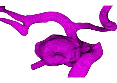 Know Your Mesh For Cfd In Biomedical Applications Gridpro Blog