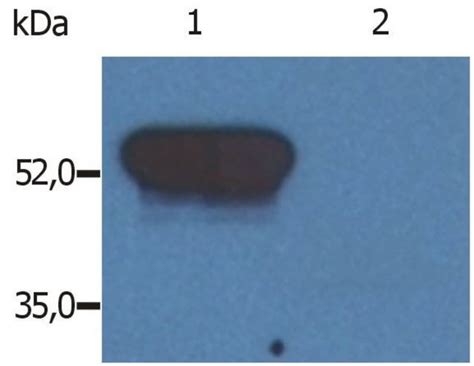 Invitrogen Gfap Monoclonal Antibody Gf 02 100 μg Unconjugated