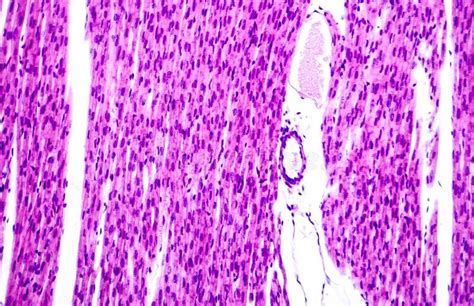 Heart Muscle Light Micrograph Stock Photo Image Of Cardiac Myocyte