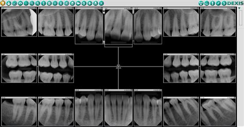 Dental Radiology Fmx