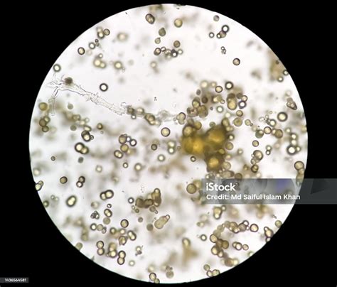 소변 검사의 현미경 이미지 비정상적인 소변 검사 요산 결정 0명에 대한 스톡 사진 및 기타 이미지 0명 개념 개념과 주제 Istock