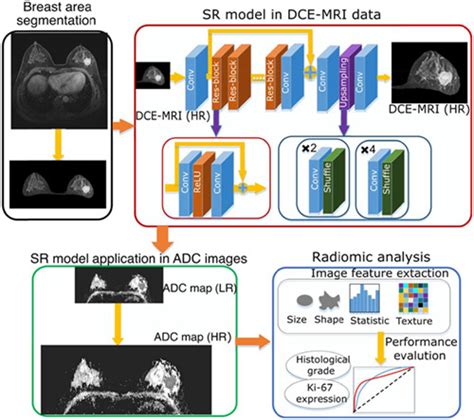 Generative Adversarial Networkbased Superresolution Of Diffusionweighted Imaging Application
