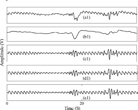 Figure 1 From A Novel Approach For Motion Artifact Reduction In Ppg Signals Based On As Lms