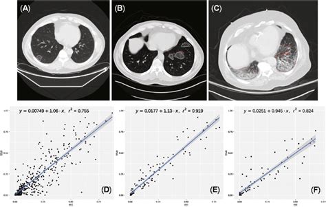 Results Of The Ct Segmentation Network A B C Three Segmentation