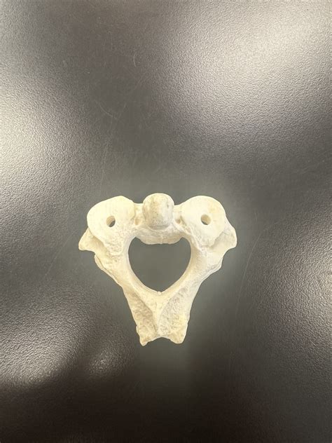 Vertebrae Diagram Quizlet