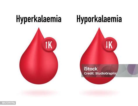 Hyperkalaemia High Plasma Potassium Level And Hypokalaemia Low Plasma Potassium Level Potassium
