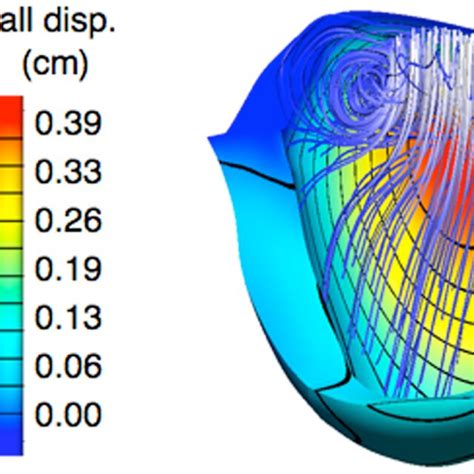 example of results from fluid structure interaction fsi simulations