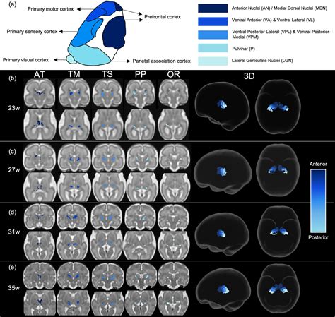 Spatiotemporal Tissue Maturation Of Thalamocortical Pathways In The