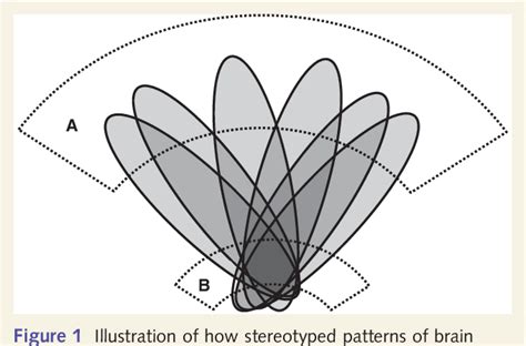 Figure 1 From Human Brain Lesion Deficit Inference Remapped Semantic Scholar