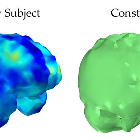 Healthy Subjects Shear Modulus G Of The Brain Derived By Mre The Download Scientific
