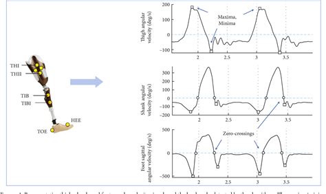 Figure 1 From Estimation Of Gait Parameters For Transfemoral Amputees Using Lower Limb