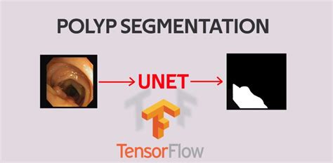 Polyp Segmentation Using Unet In Tensorflow 20 Idiot Developer