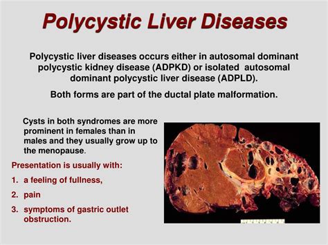 PPT Diffuse Liver Disease PowerPoint Presentation Free Download ID