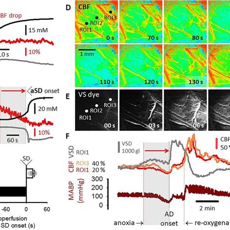 The Temporal Sequence And The Latency Between Spreading Depolarization