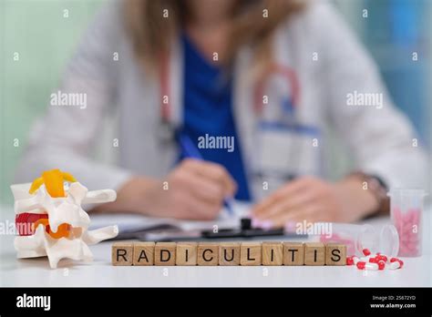 A Doctor Is Examining Radiculitis Using A Detailed Spinal Model For