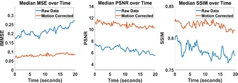 Figure 2 From A Novel Intraoperative Mapping Device Detects The Thermodynamic Response Function