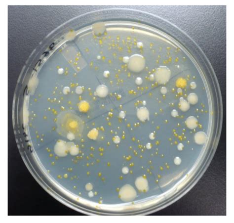 Ch 9 Microbial Growth Flashcards Quizlet