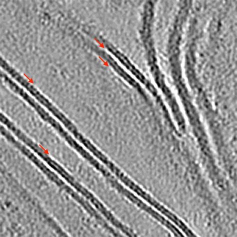 white density around the denoised membrane · issue 32 · juglab