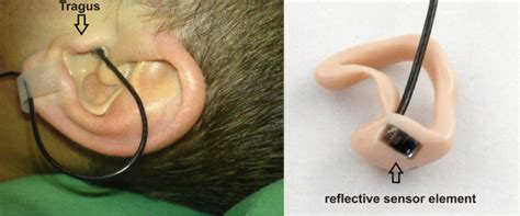 Patient With Reflective PPG Sensor Which Is Sealed Into An Individually Download Scientific